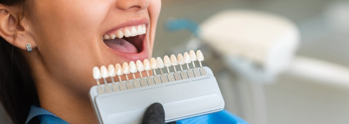 CERAMIC IMPLANTS - Dr. Piela